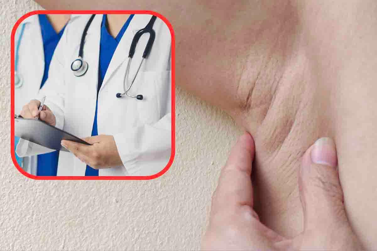 Nodulo sotto l'ascella, si tratta di linfonodi ingrossati: ecco quando devi correre dal medico ...